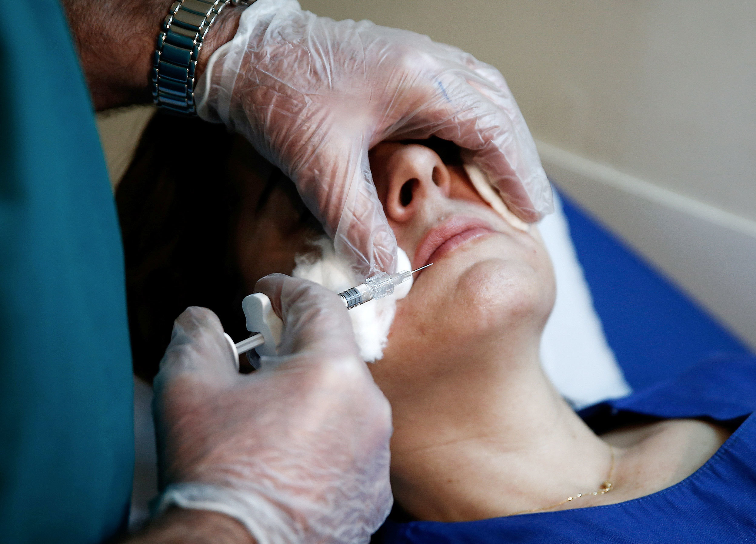 AbbVie koopt Botox-maker Allergan voor $63 mrd